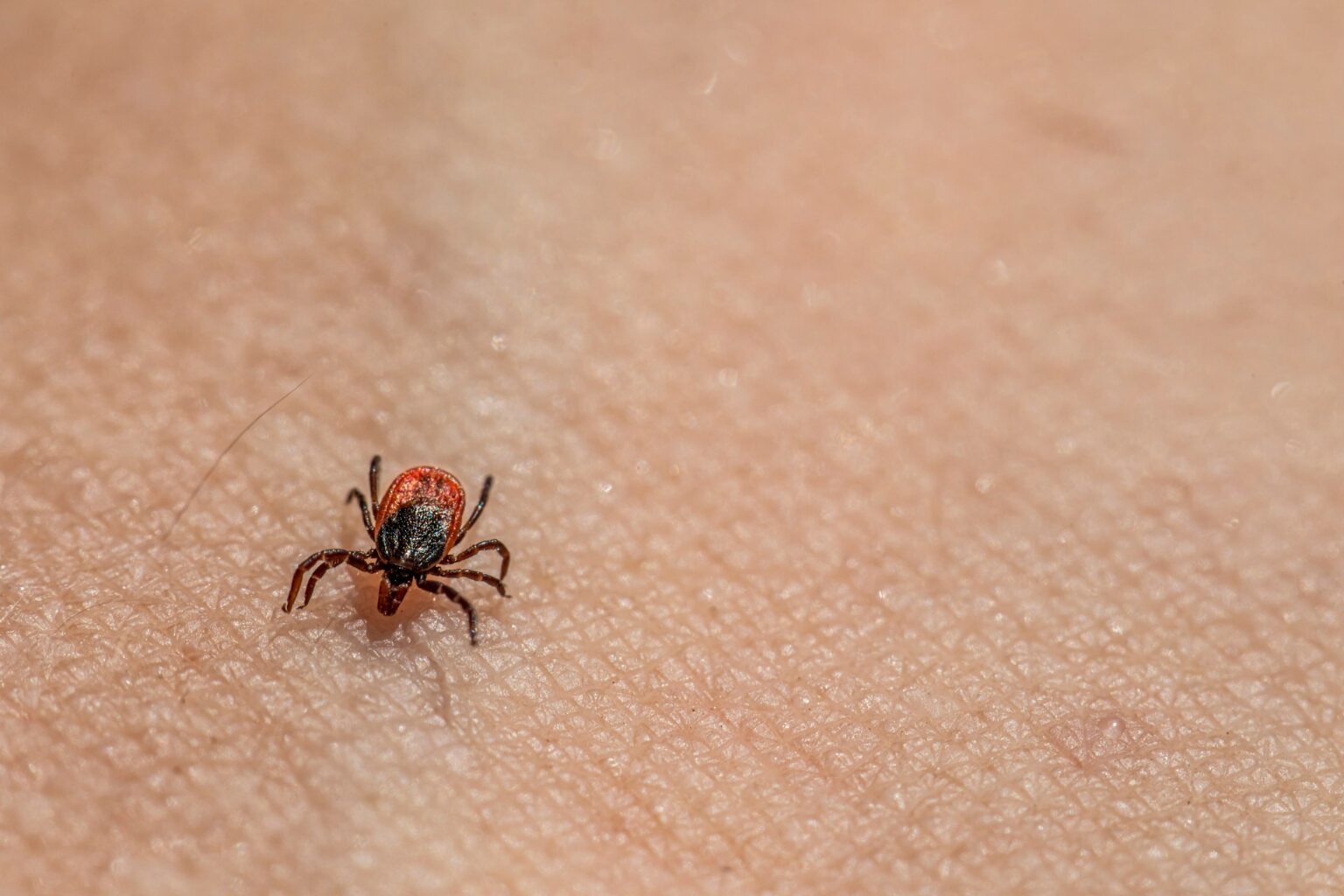 How Black Widow Venom Affects the Human Body – Insect Hive