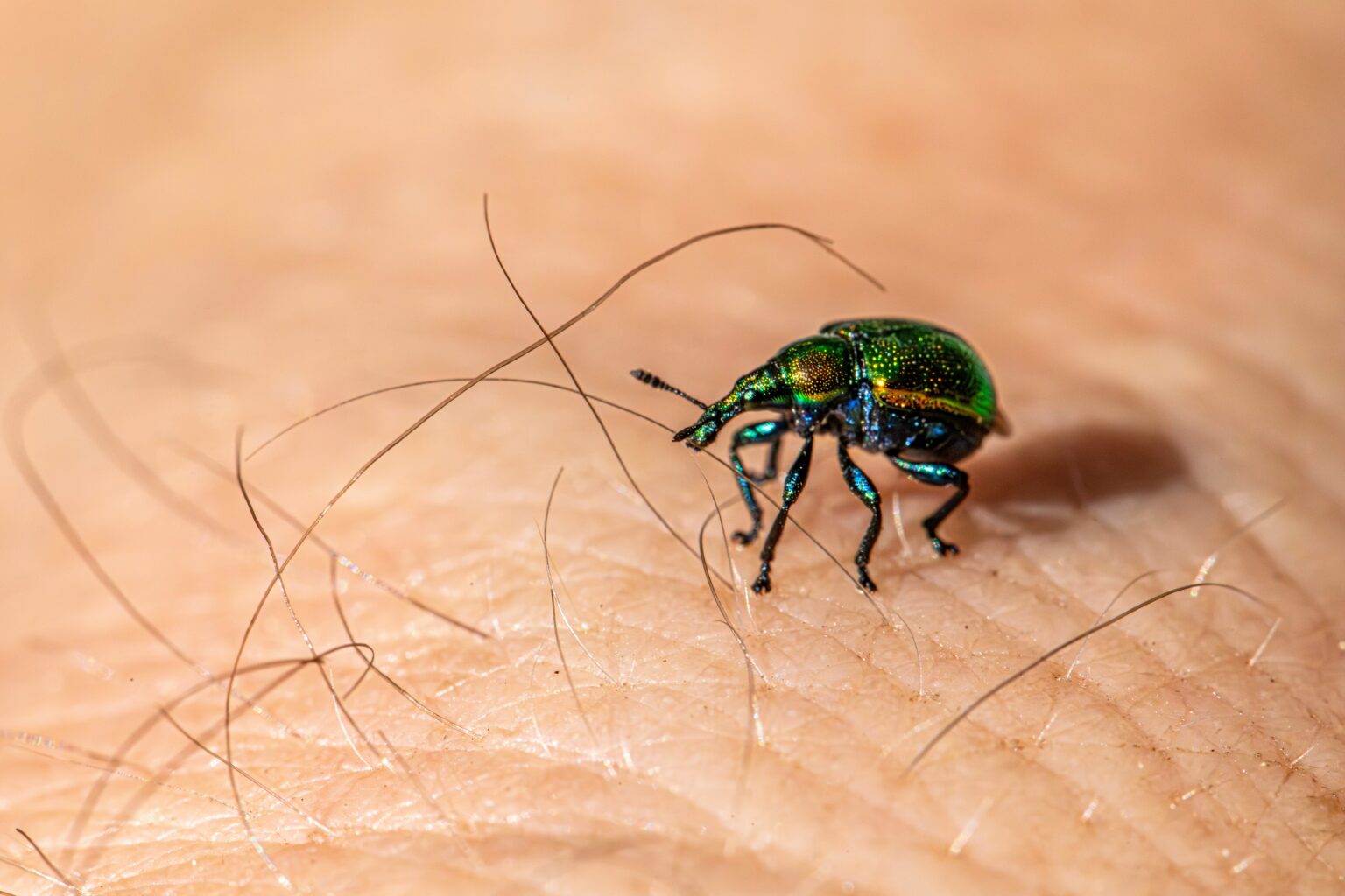 Allergies Stings and Bites Understanding Insect Reactions in Humans ...