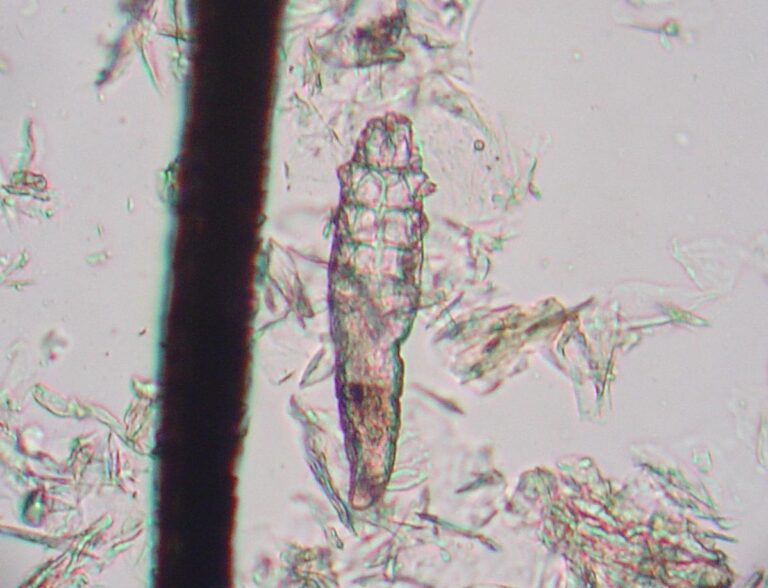Mites on Your Face: The Microscopic Insects That Live in Your Pores ...