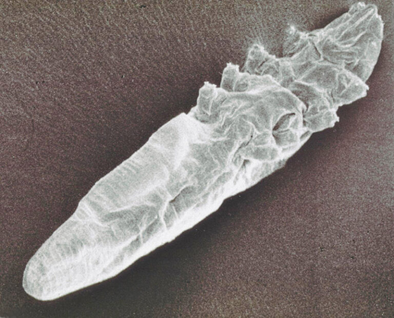Mites on Your Face: The Microscopic Insects That Live in Your Pores ...
