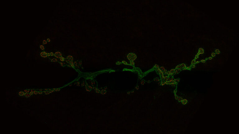 Do Flies Have Sleep Cycles What Happens in a Resting Bug Brain – Insect ...